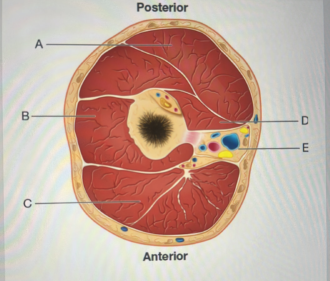 The image shows a cross-section of a limb, | StudyX