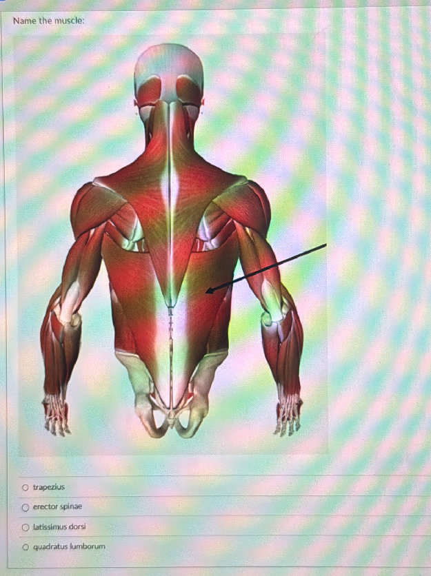 Name the muscle: [Image of human back | StudyX