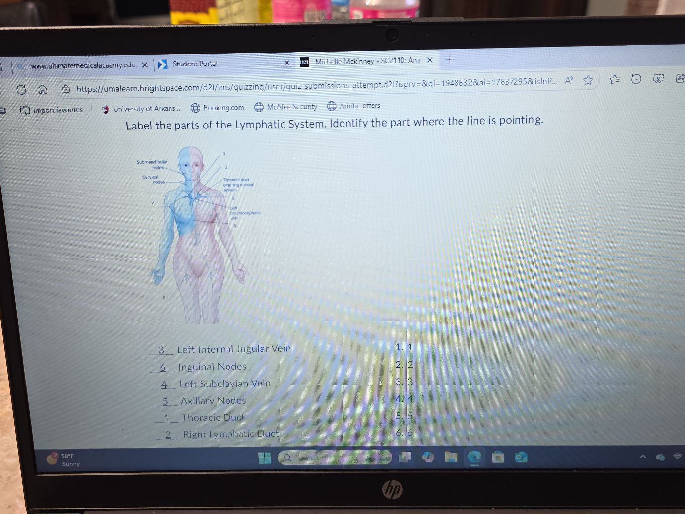 Label the parts of the Lymphatic System.