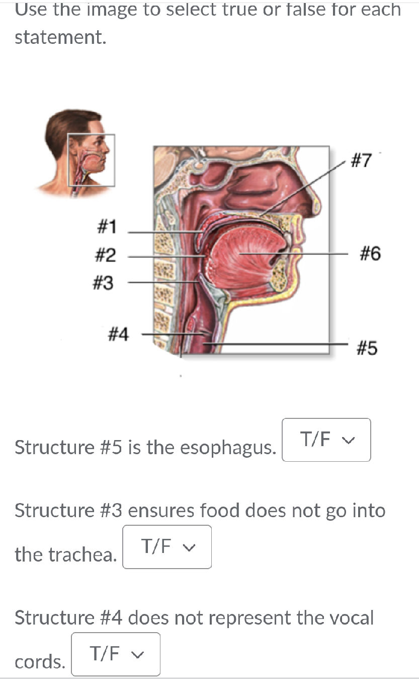 Use the image to select true or false for | StudyX