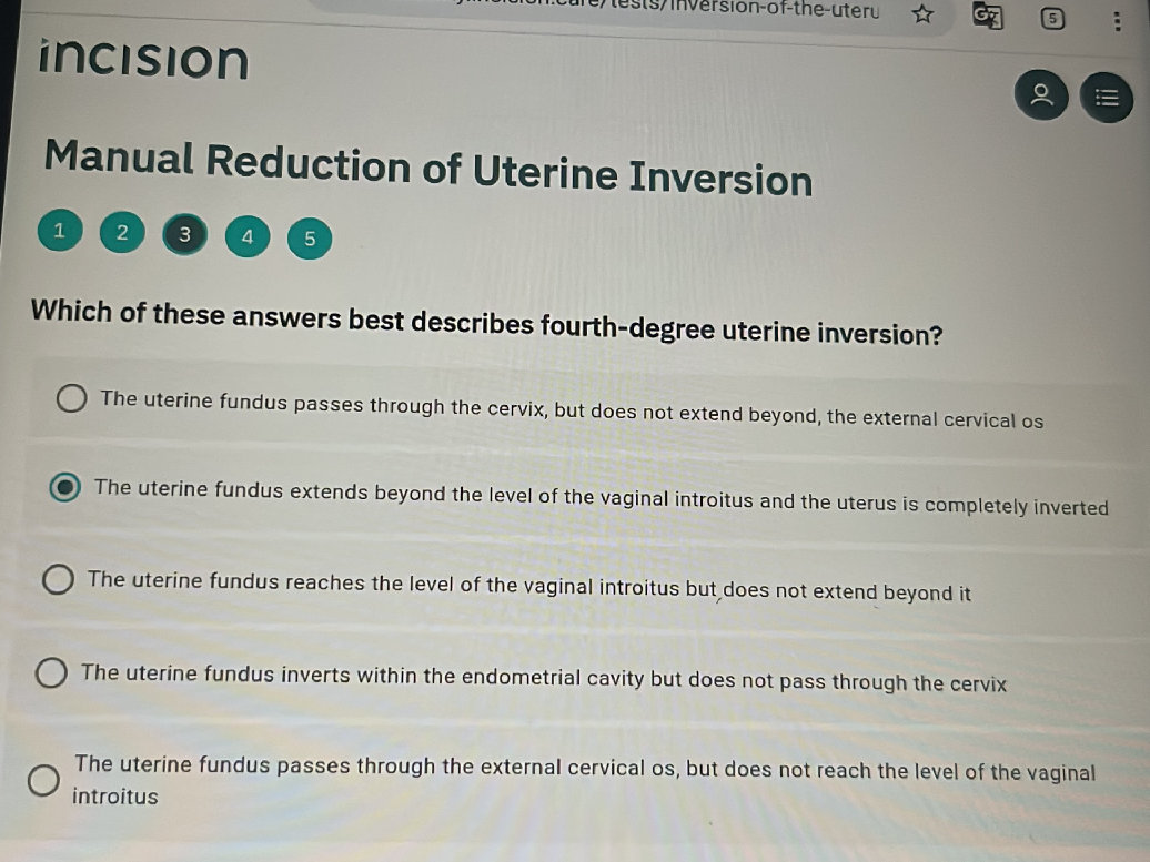 Manual Reduction of Uterine Inversion Which | StudyX