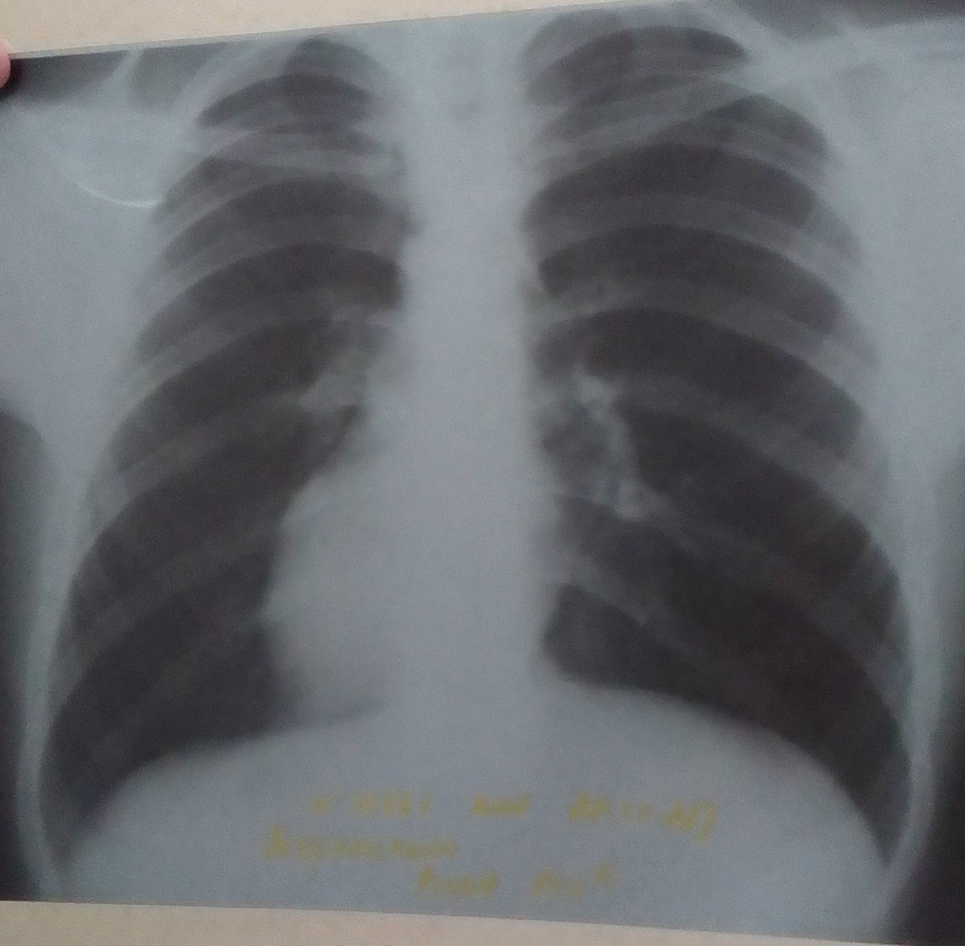 This image displays a chest X-ray | StudyX