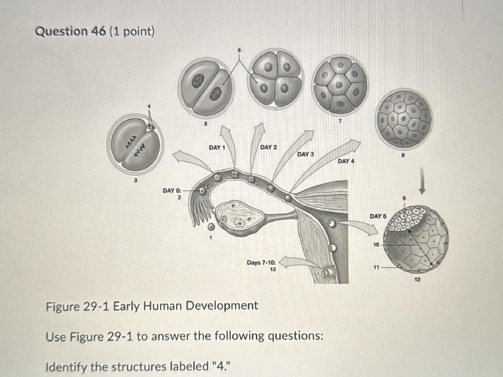Question 46 (1 point) Figure 29-1 Early | StudyX