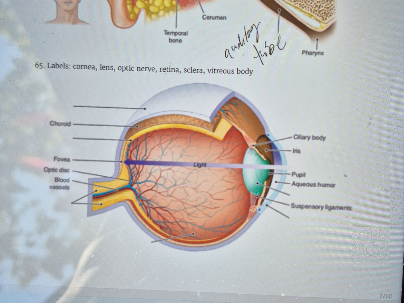 65. Labels: cornea, lens, optic nerve, | StudyX