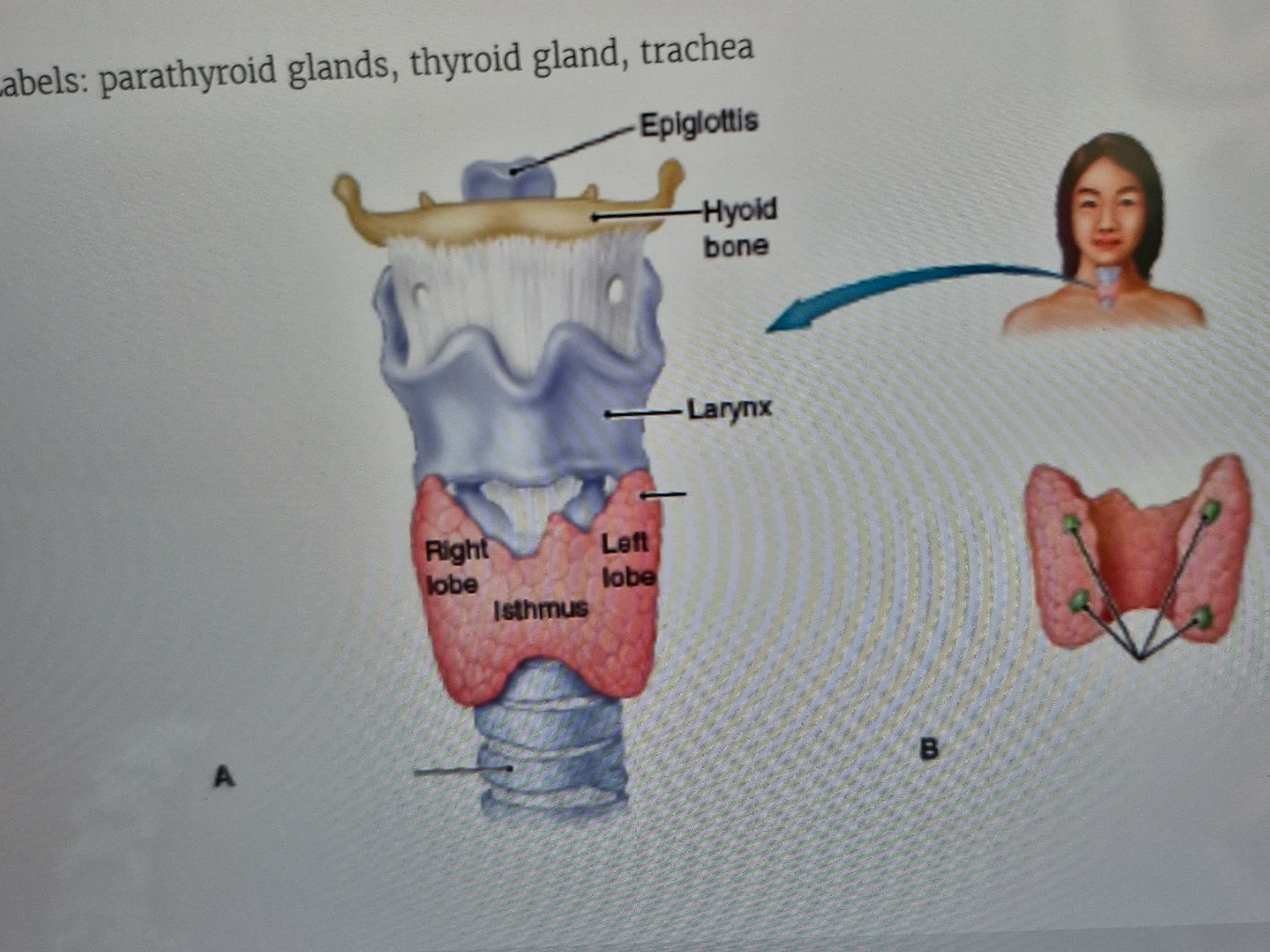Labels: parathyroid glands, thyroid gland, | StudyX