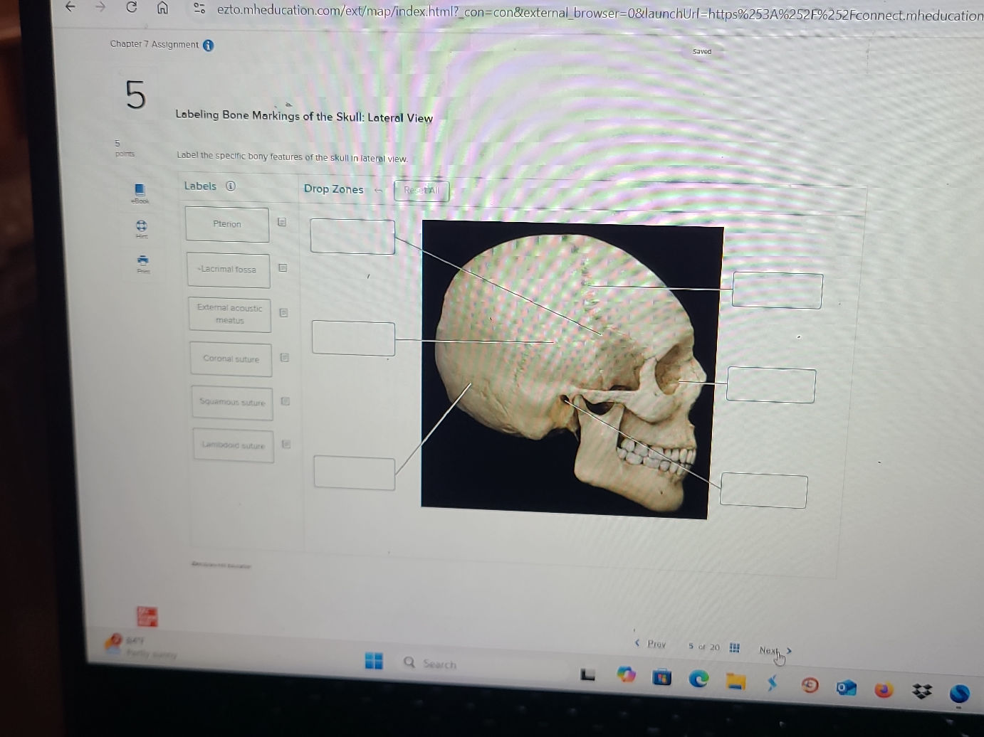 Labeling Bone Markings of the Skull: Lateral