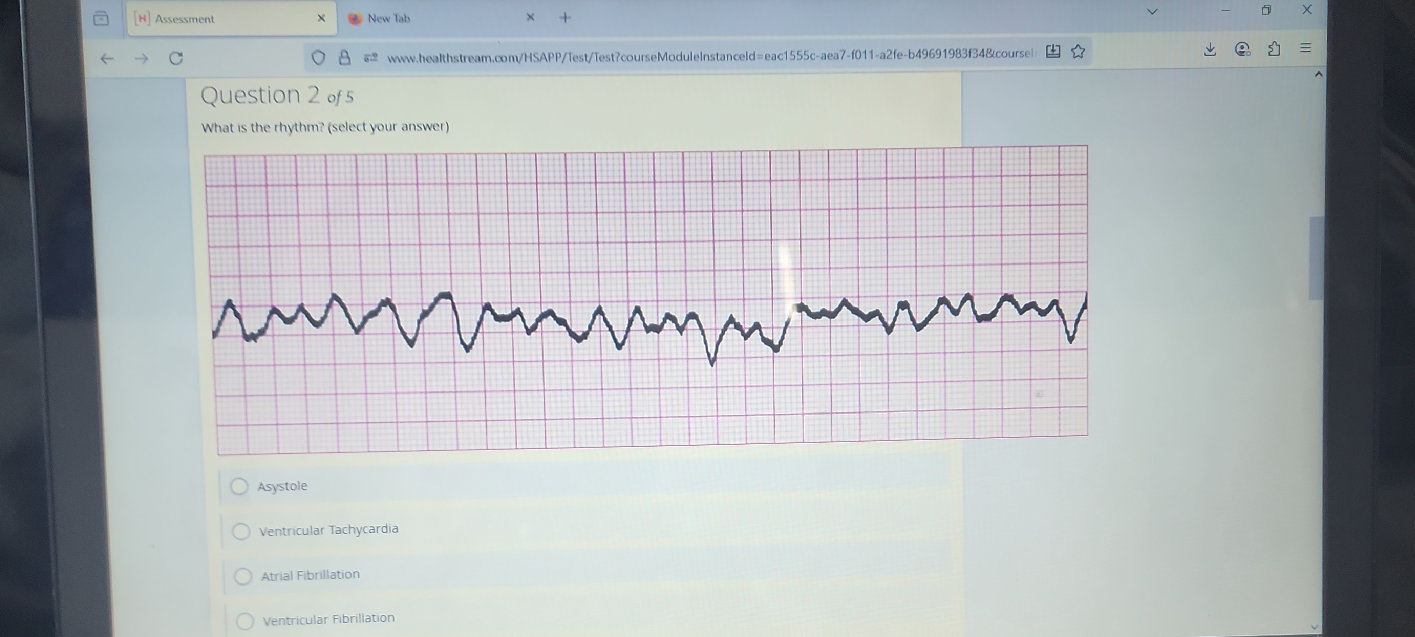 Question 2 of 5 What is the rhythm? (select | StudyX