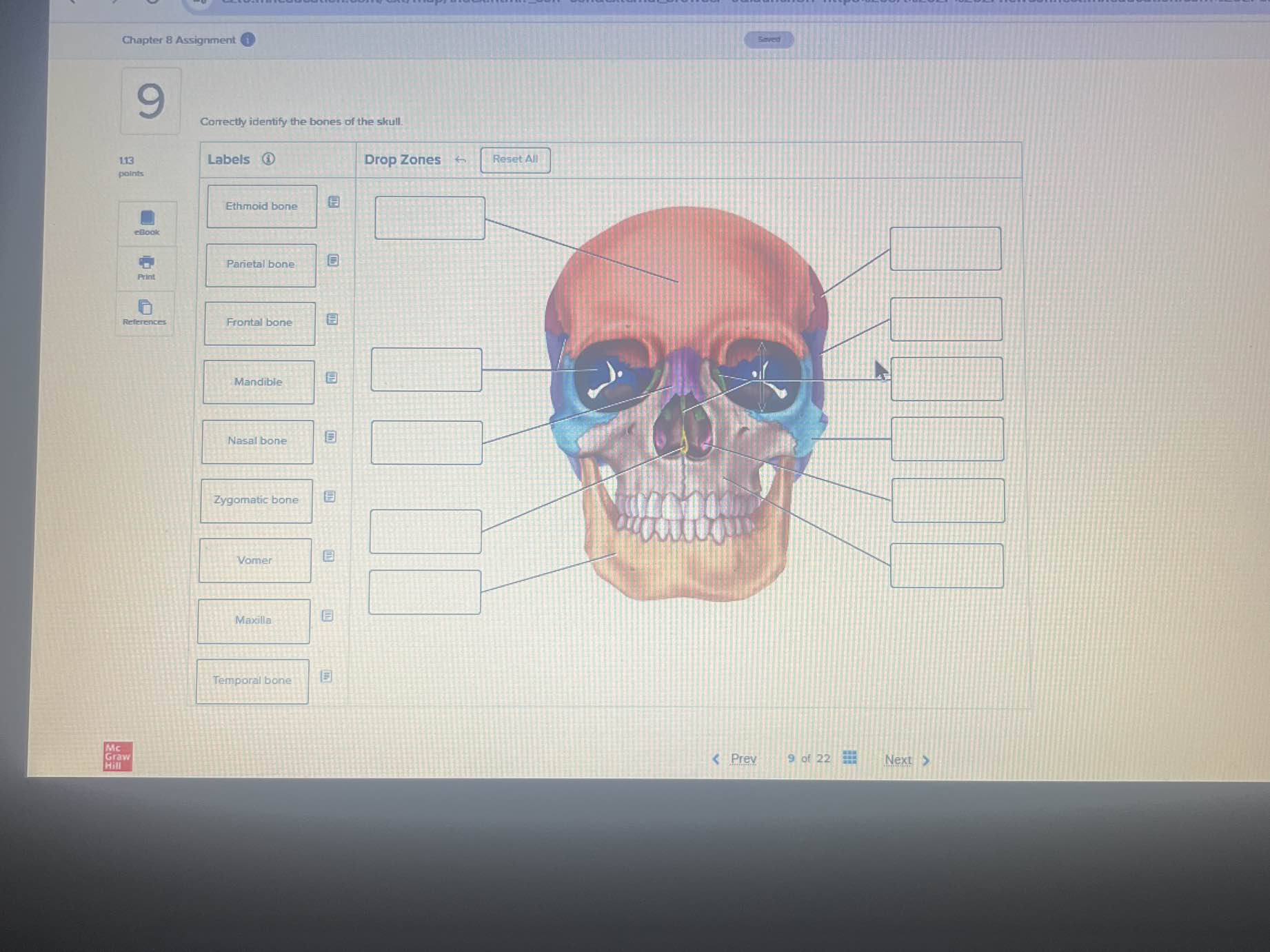 Correctly identify the bones of the skull. | StudyX