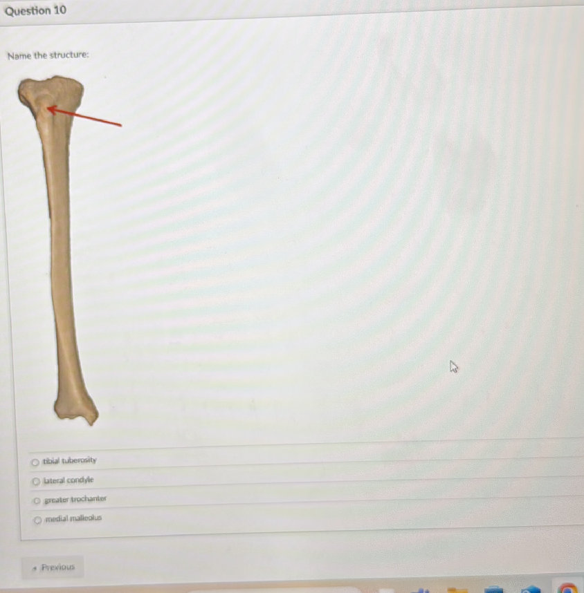 Name the structure: (Image shows a bone, | StudyX