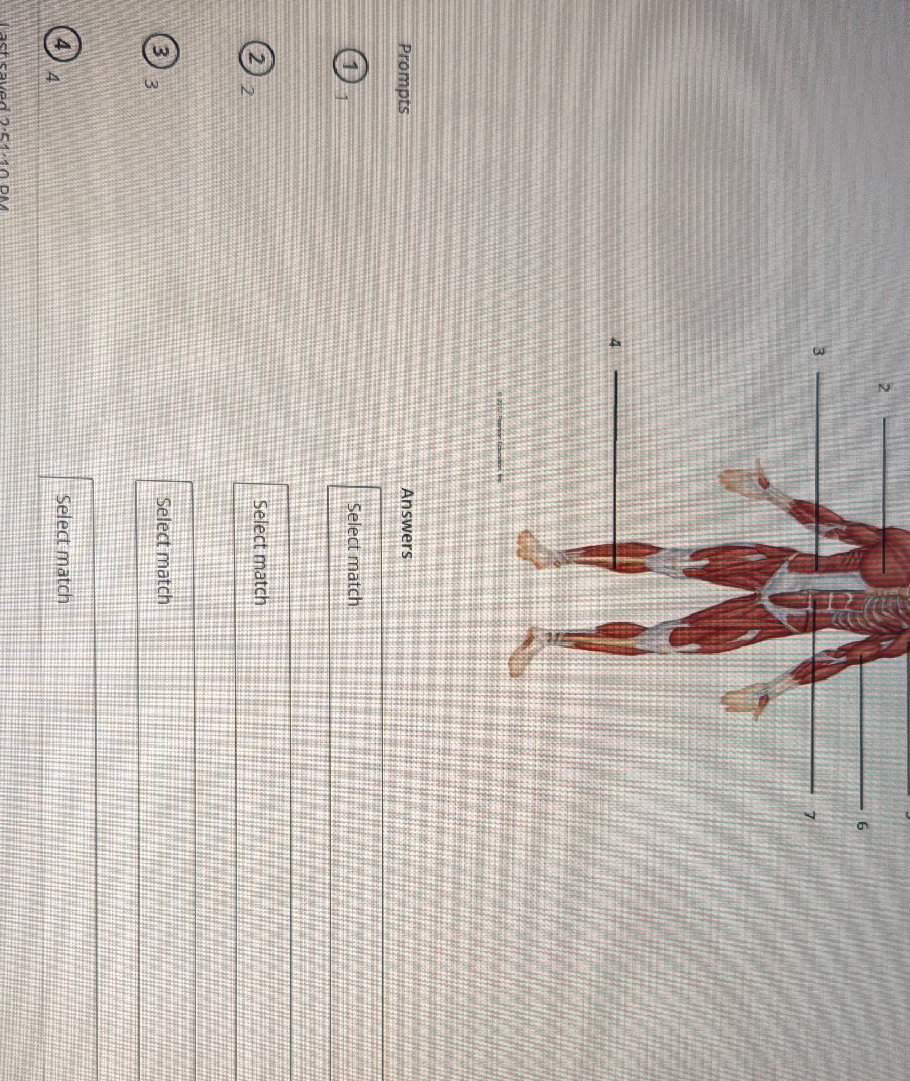 The image shows a posterior view of the | StudyX