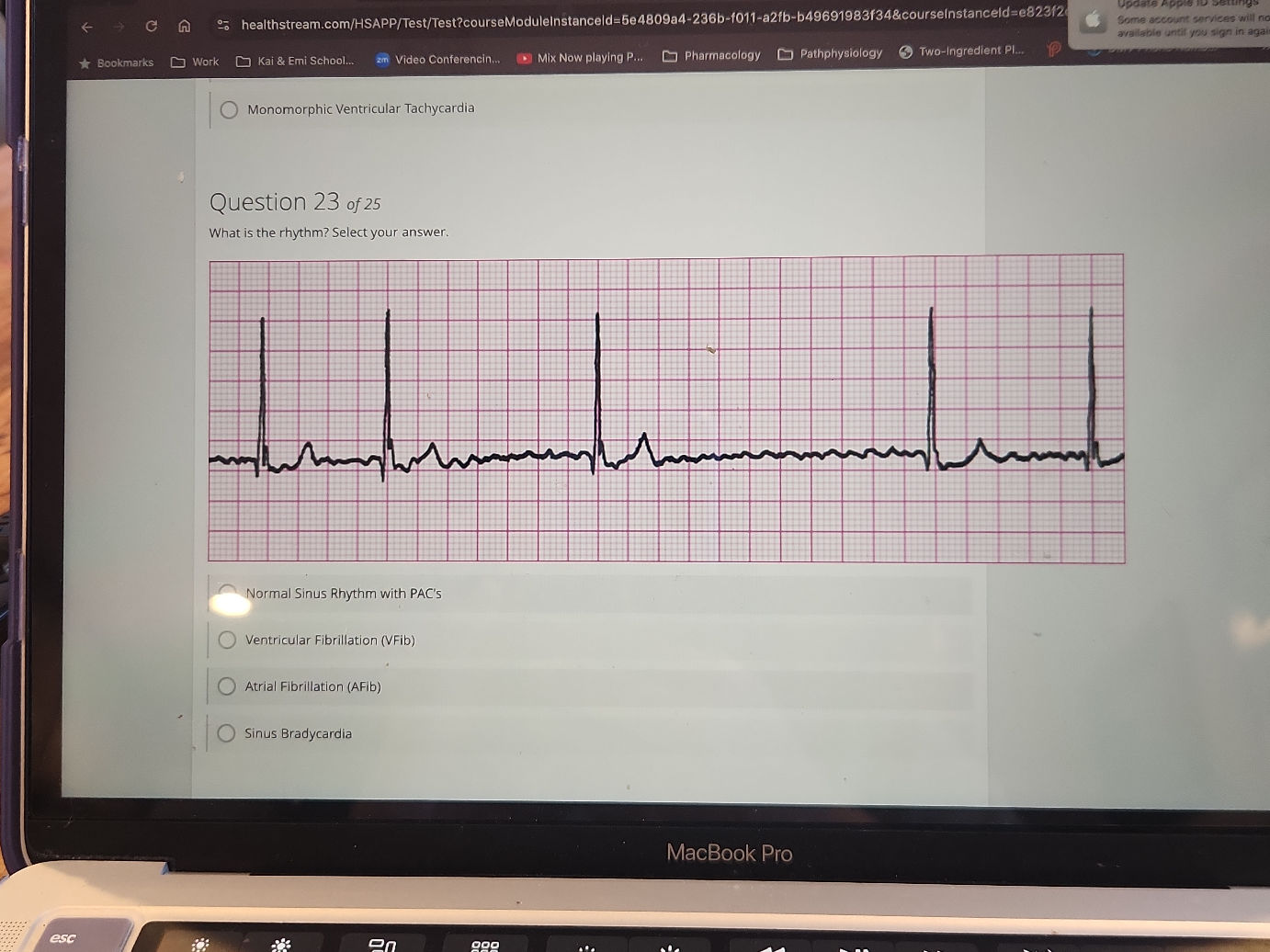Question 23 of 25 What is the rhythm? Select | StudyX
