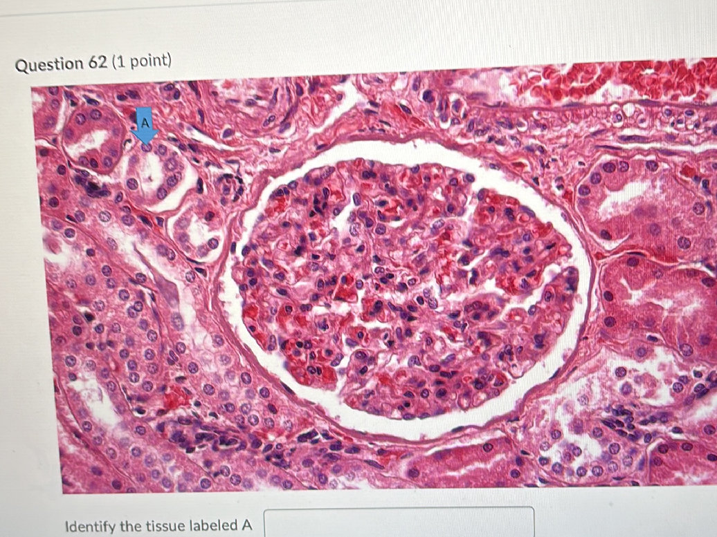 Question 62 (1 point) Identify the tissue | StudyX