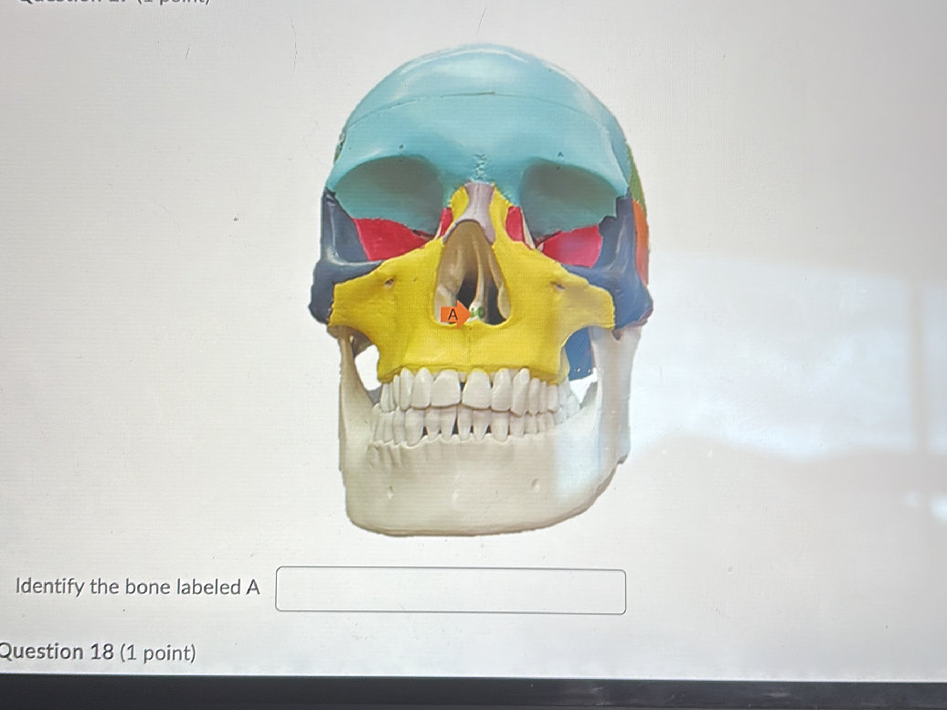 Question 17 (1 point) Identify the bone | StudyX