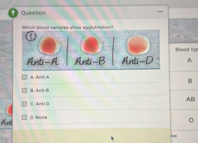 Which blood samples show agglutination? ① | StudyX