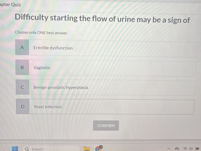 Difficulty starting the flow of urine may be | StudyX