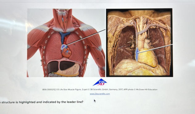 What structure is highlighted and indicated | StudyX