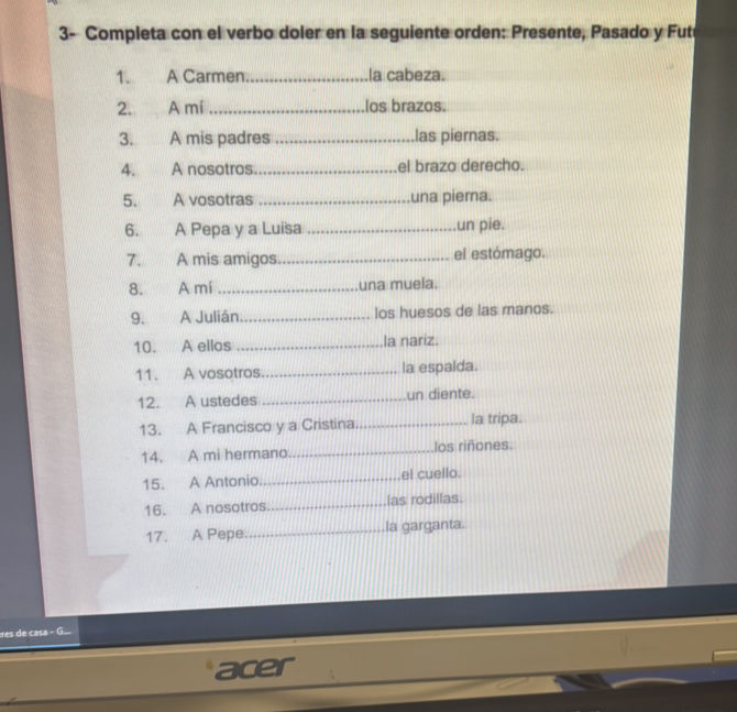 3- Completa con el verbo doler en la