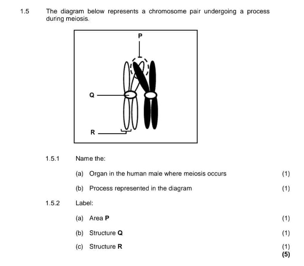 The diagram below represents a chromosome | StudyX
