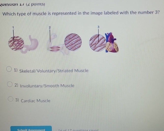 Which type of muscle is represented in the