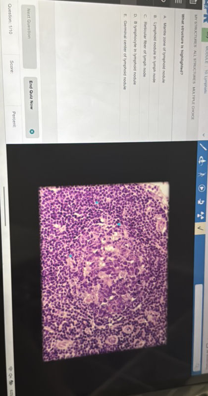 What structure is highlighted A Mantle zone | StudyX