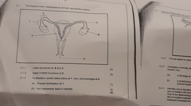 The diagram below represents the female | StudyX