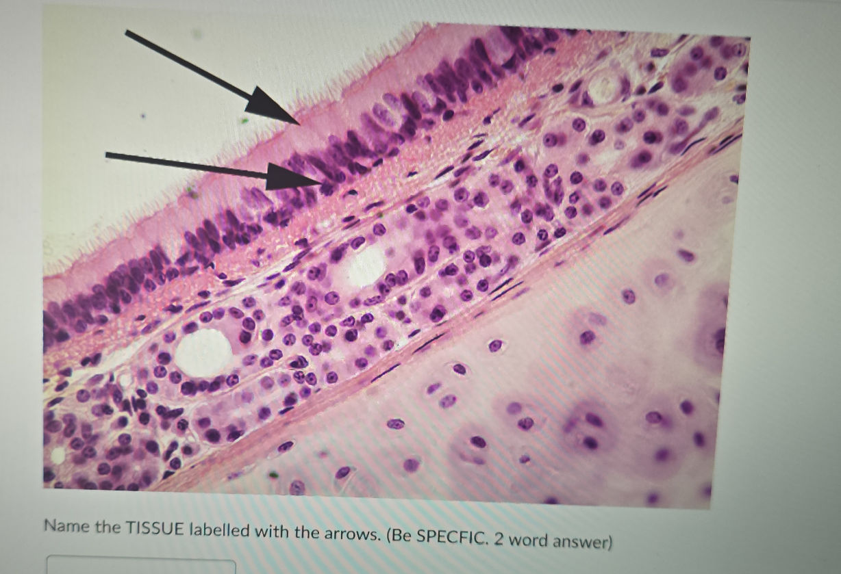 Name the TISSUE labelled with the arrows. | StudyX