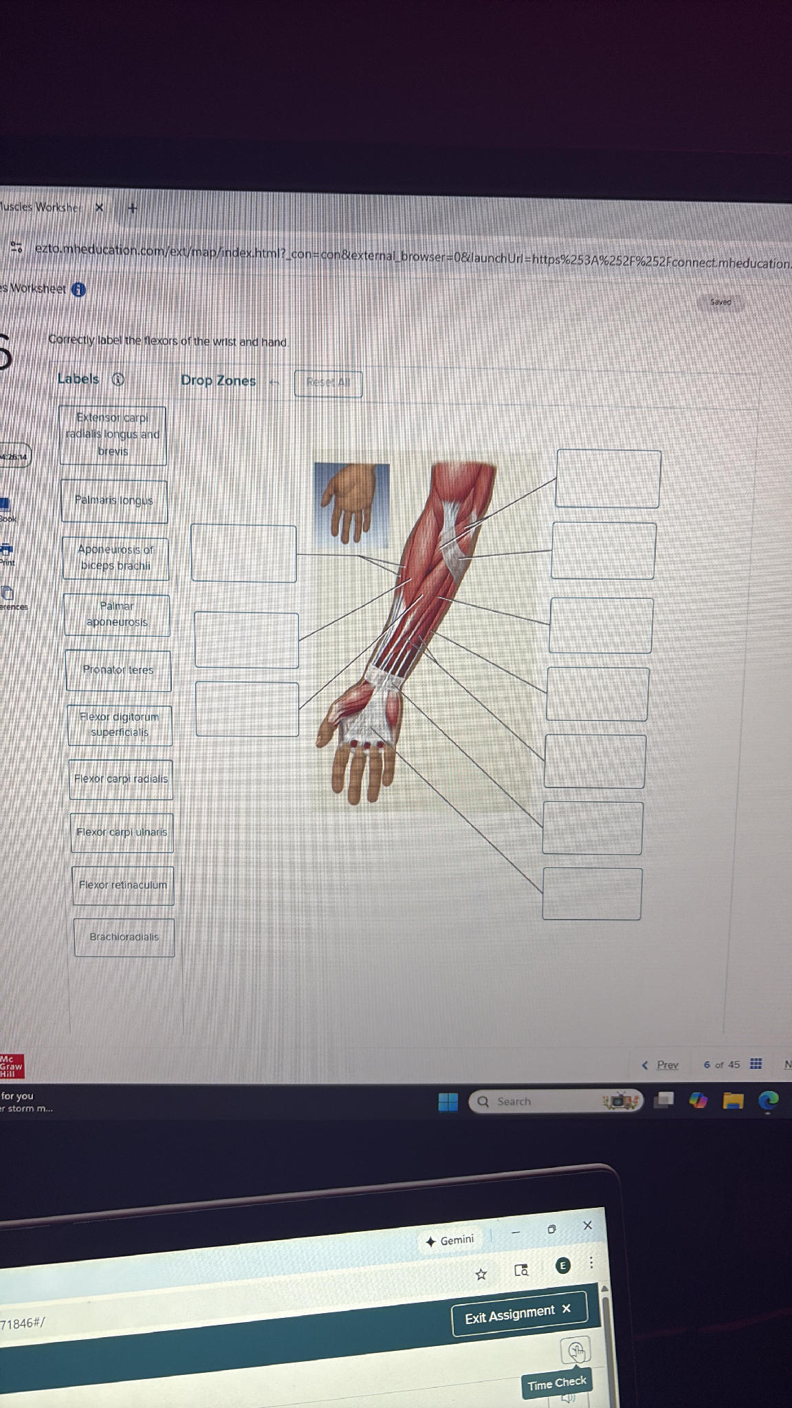 Correctly label the flexors of the wrist and | StudyX