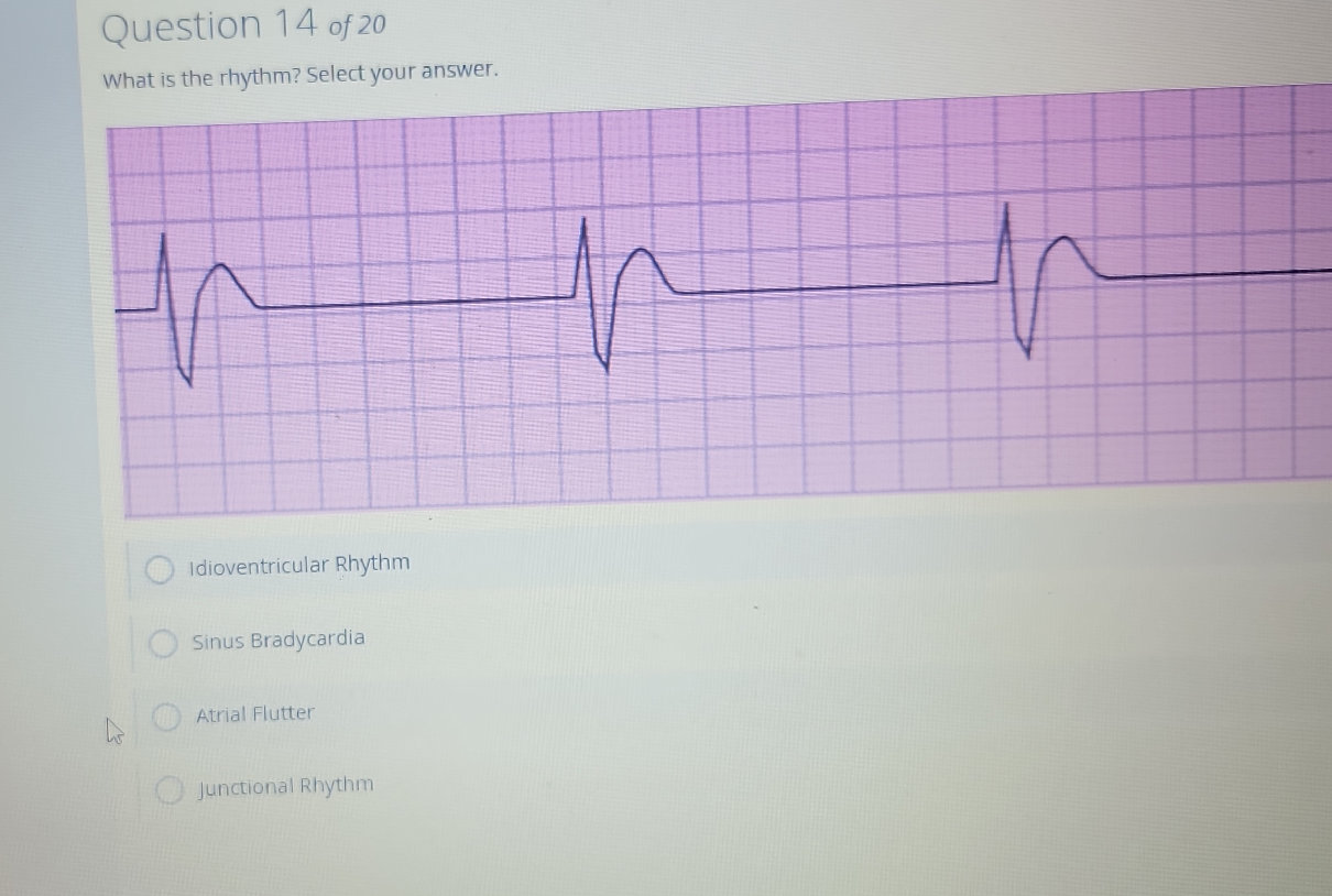 What is the rhythm? Select your answer. | StudyX
