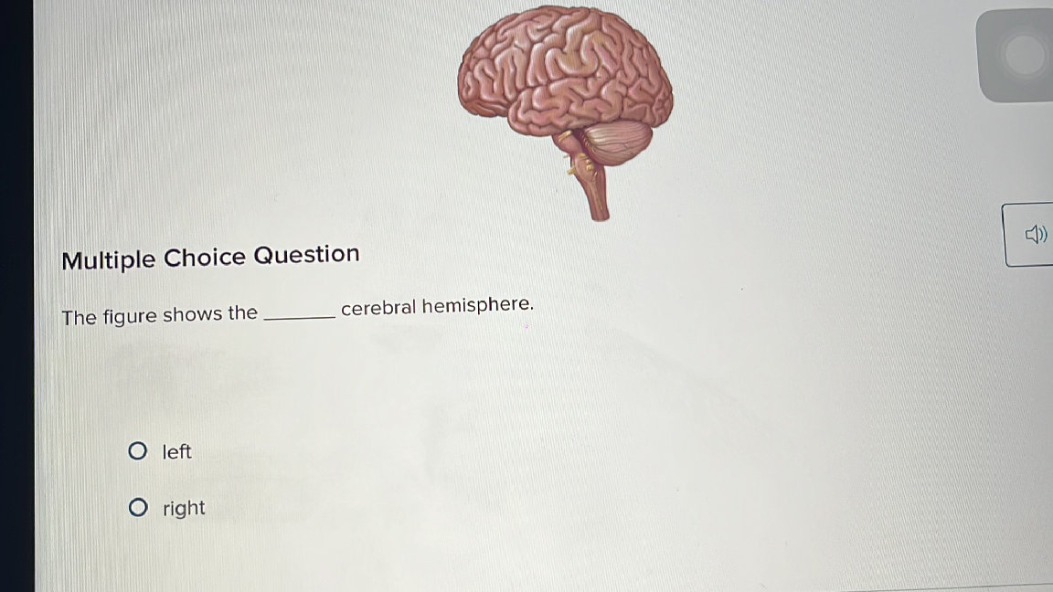 The figure shows the ______ cerebral | StudyX