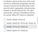 A catheter is placed at the level of the