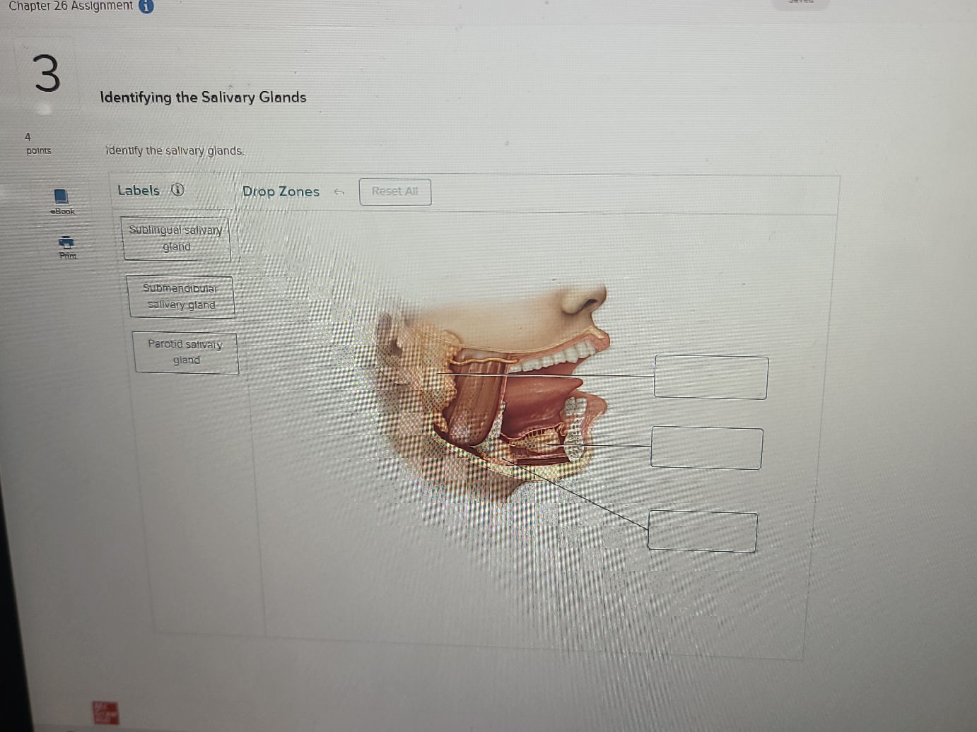 Identifying the Salivary Glands Identify | StudyX