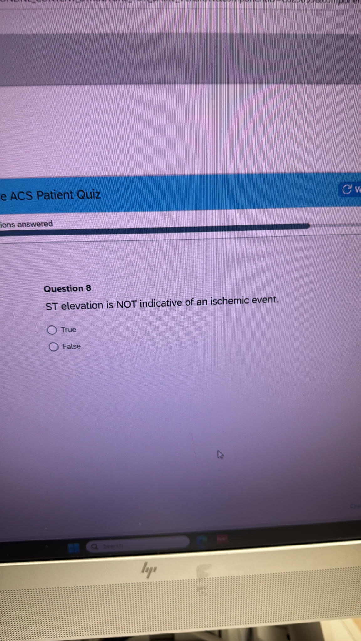 ST elevation is NOT indicative of an | StudyX