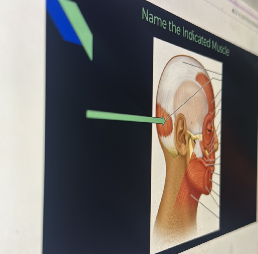 Name the indicated muscle in the head and | StudyX