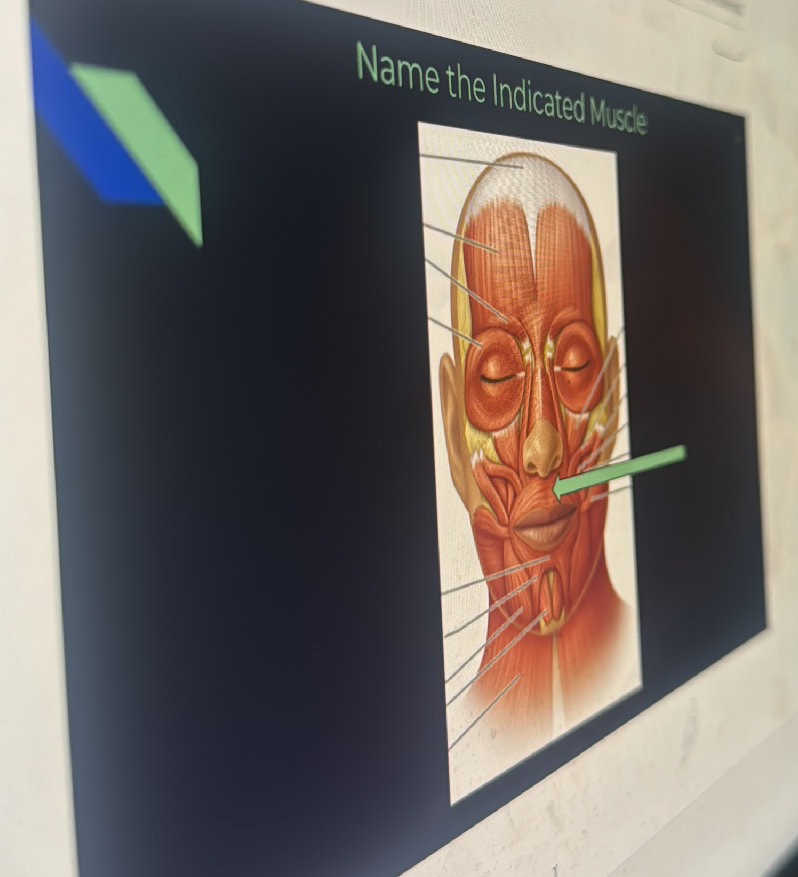 Name the Indicated Muscle (A diagram of the | StudyX