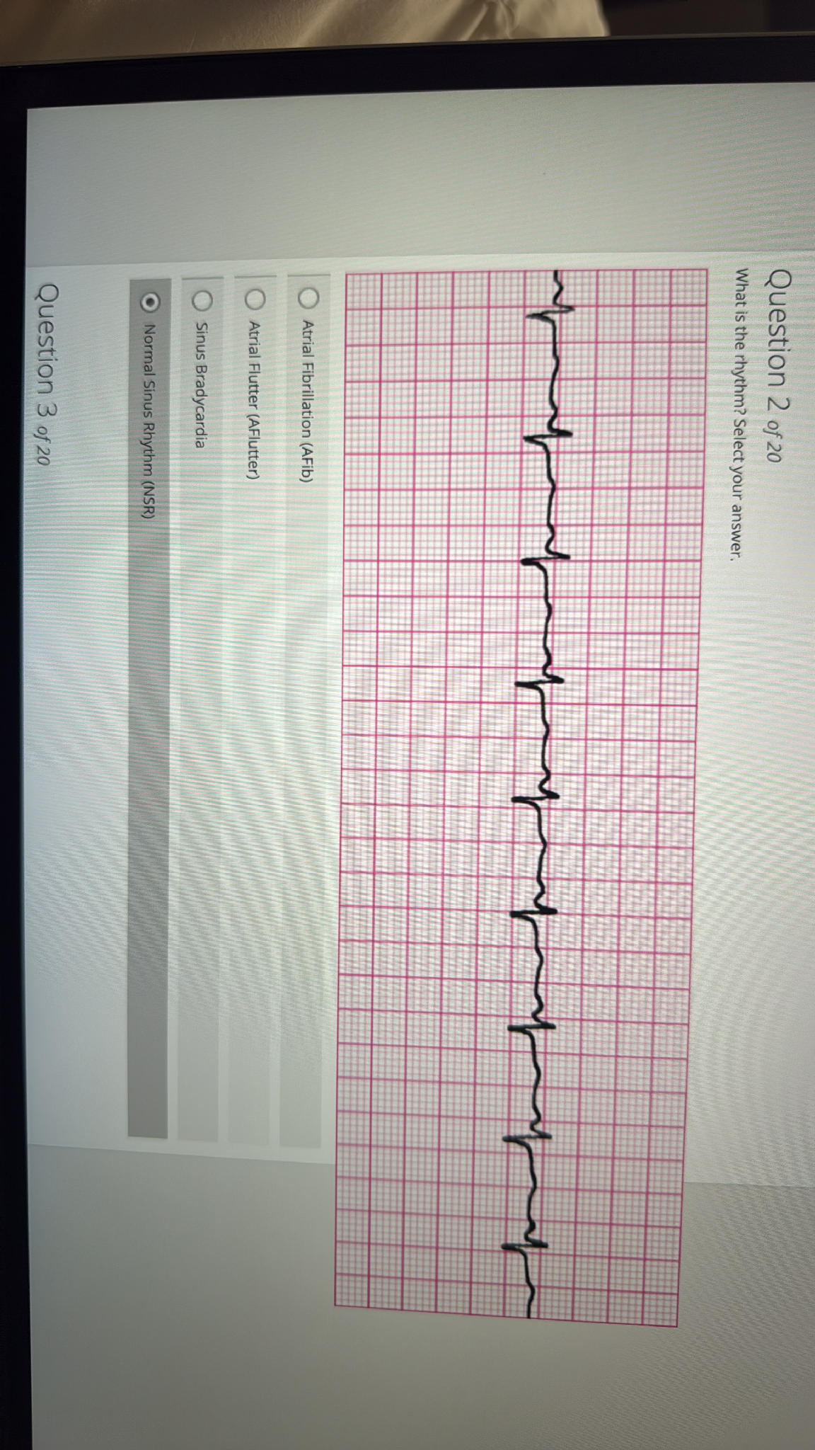 Question 2 of 20 What is the rhythm? Select | StudyX