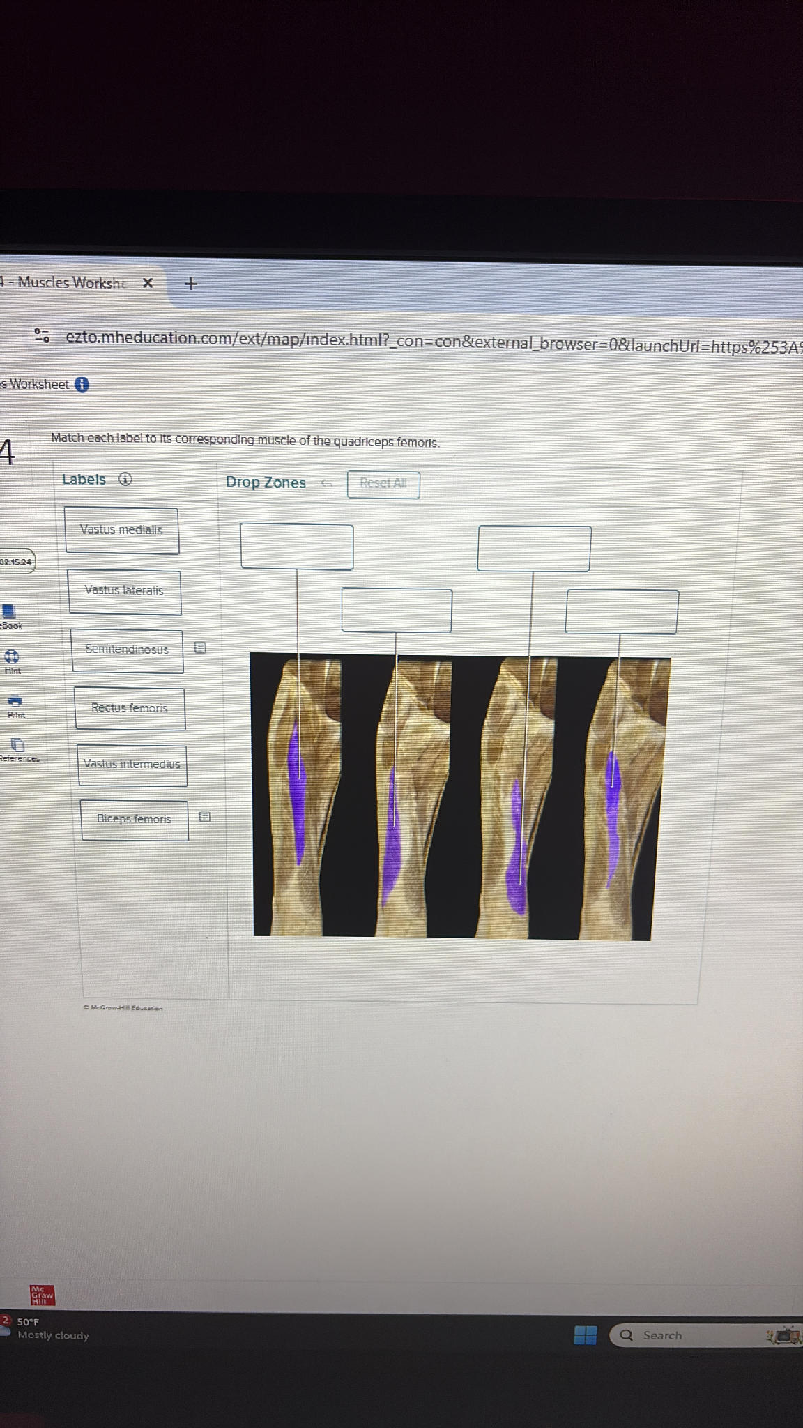 Match each label to its corresponding muscle | StudyX