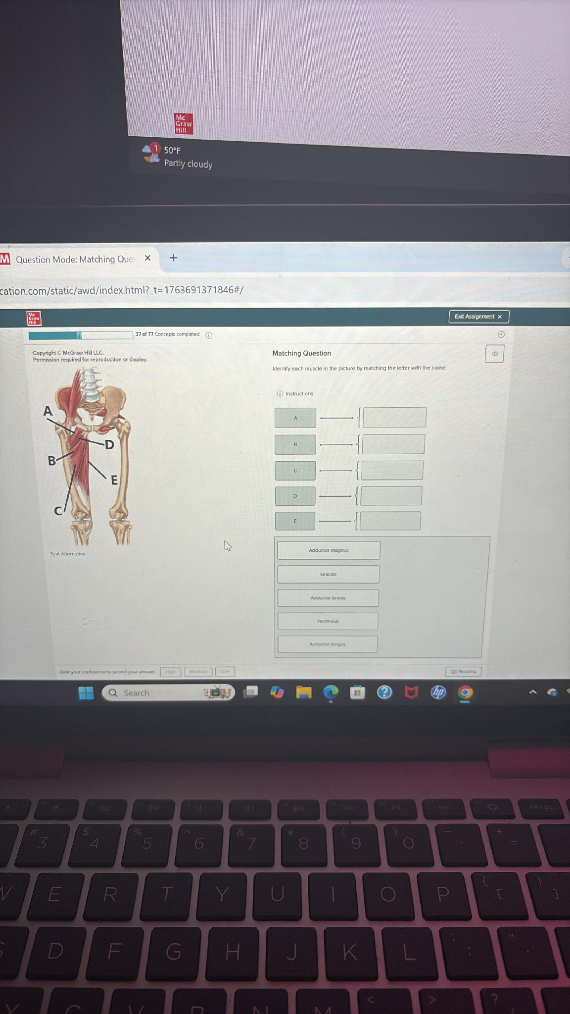 Matching Question Identify each muscle in | StudyX