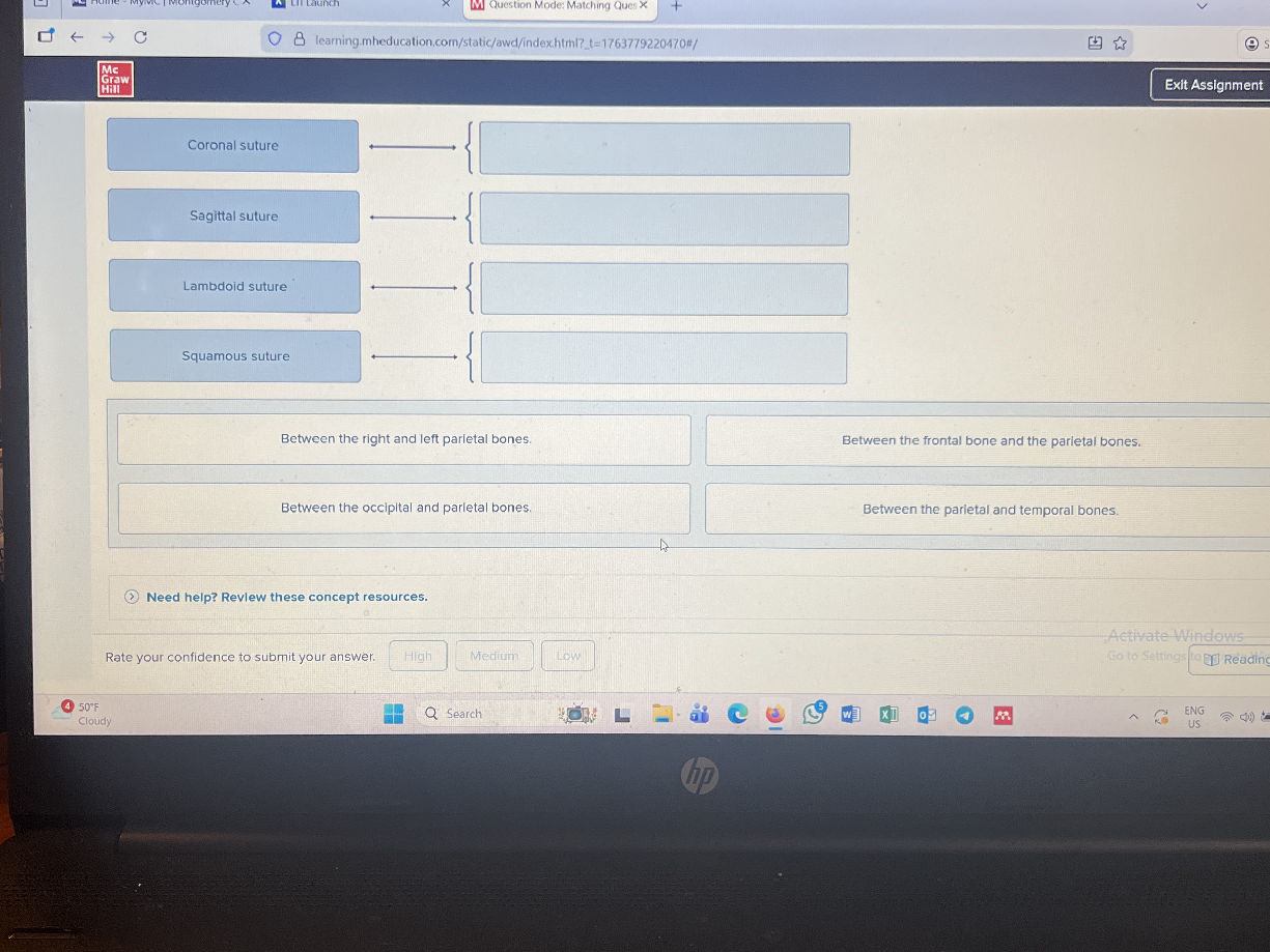 Match the following sutures with the bones | StudyX
