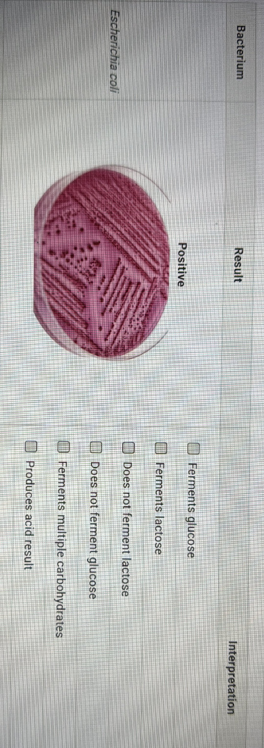 | Bacterium | Result | Interpretation | | | StudyX