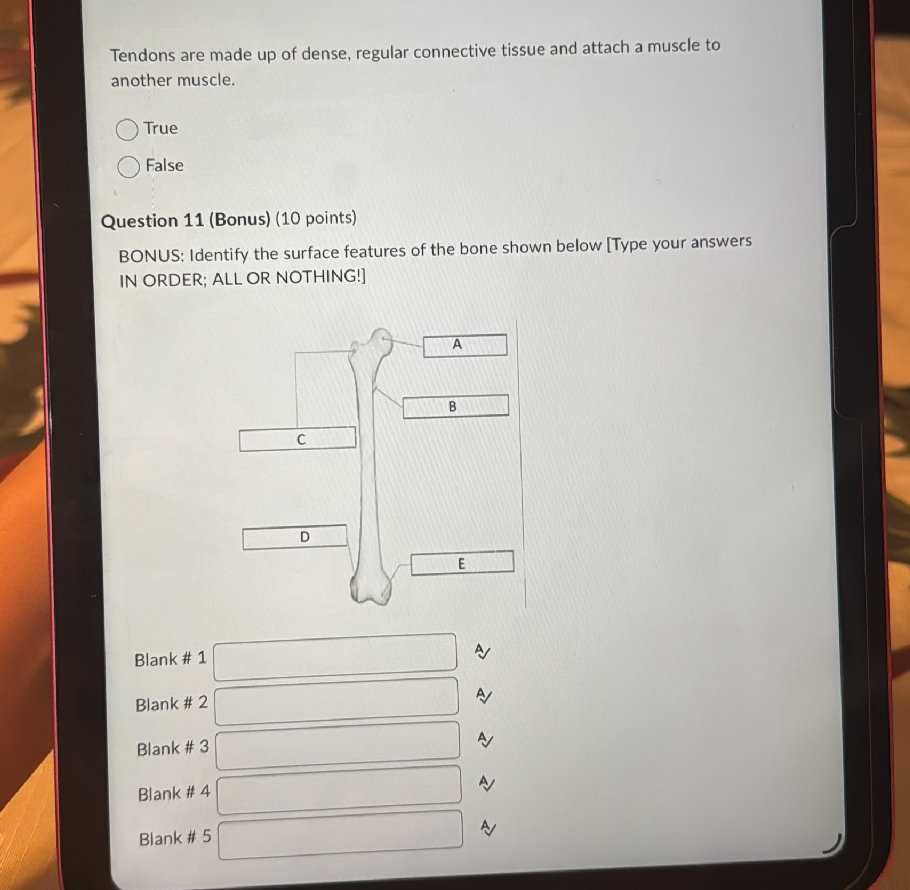 Tendons are made up of dense, regular | StudyX