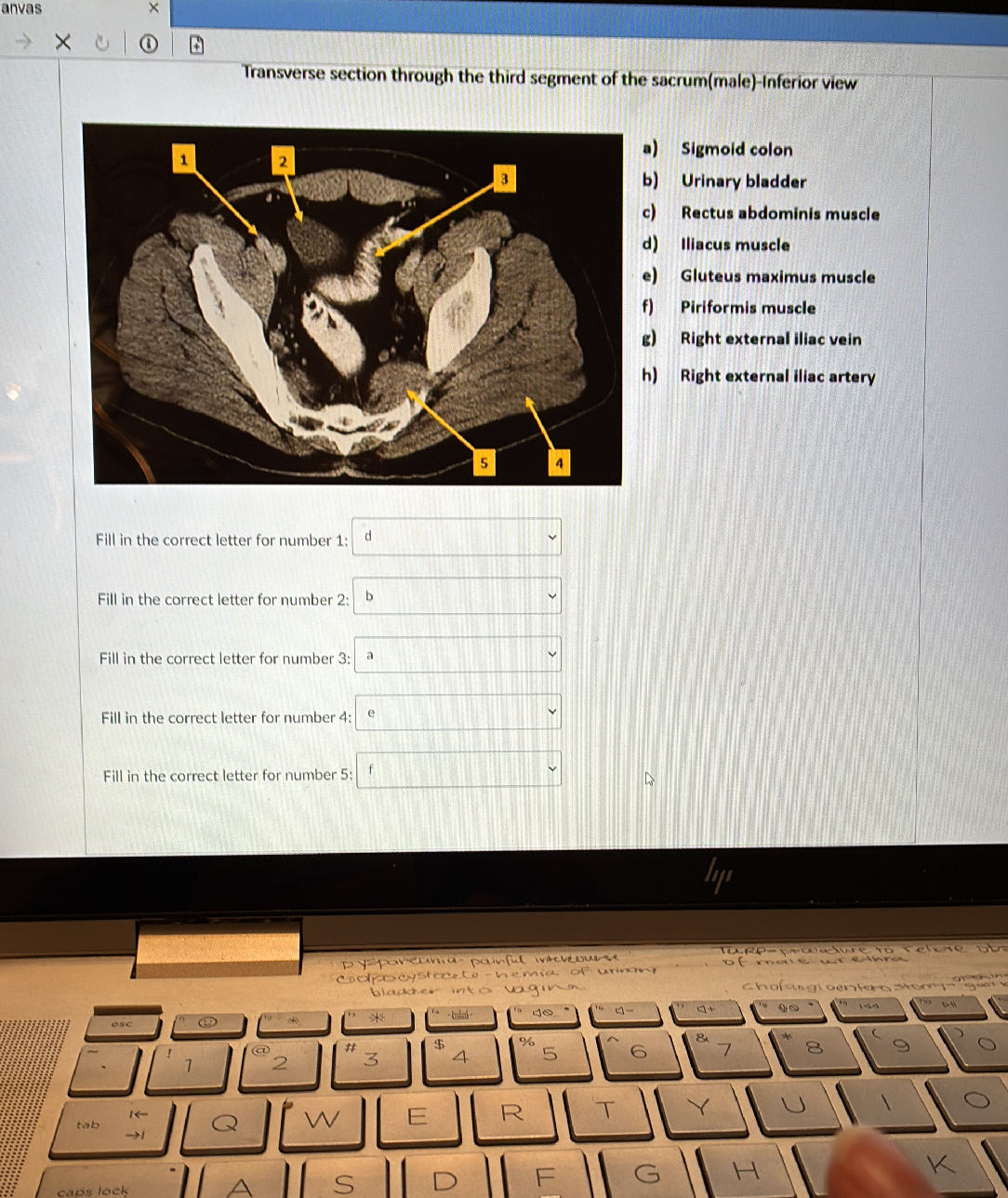 Transverse section through the third segment | StudyX