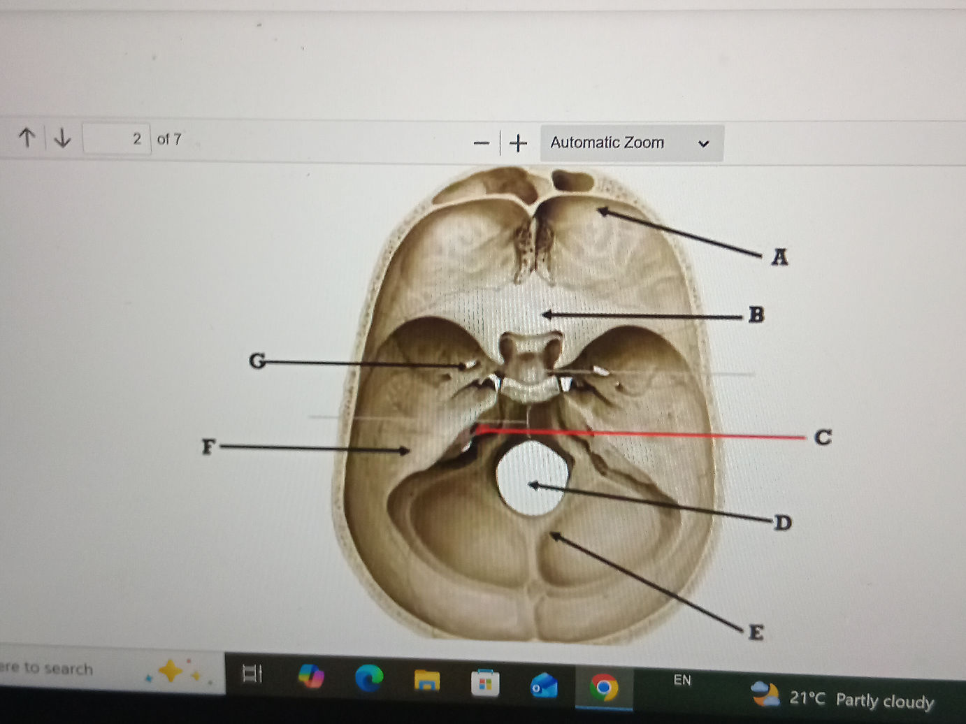 Identify the labeled structures (A, B, C, D, | StudyX