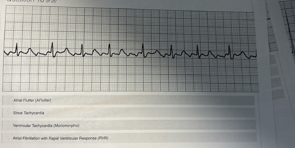 An ECG rhythm strip is shown below. Identify | StudyX