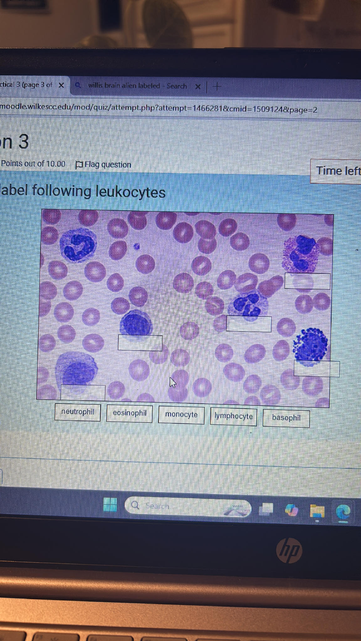 Label following leukocytes Image shows a | StudyX