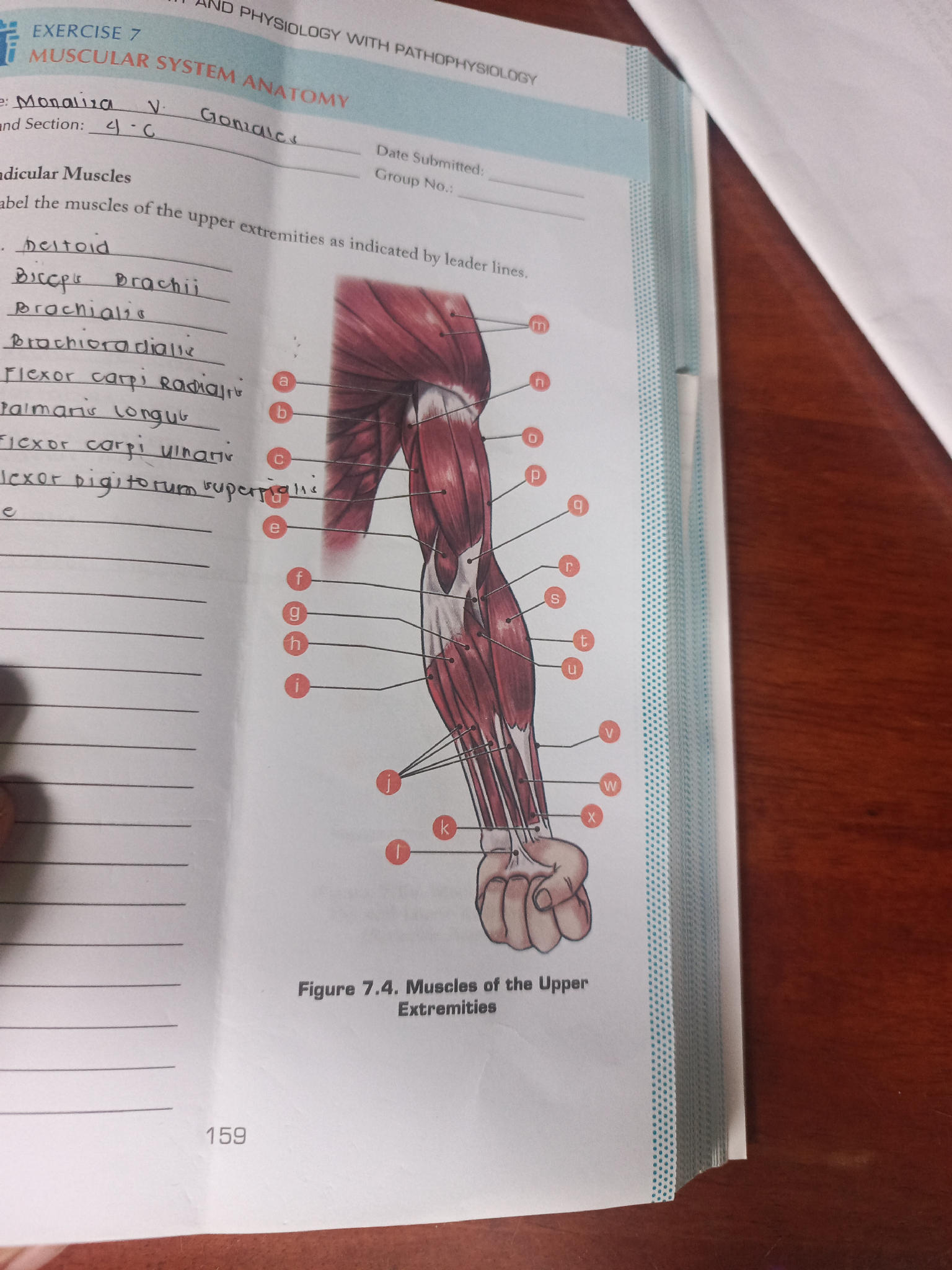 EXERCISE 7 MUSCULAR SYSTEM ANATOMY Name: | StudyX