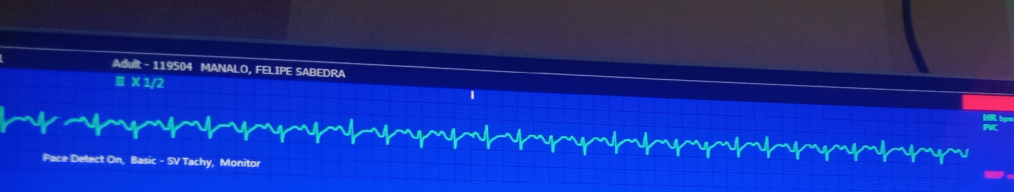 The image displays a cardiac monitor screen. | StudyX