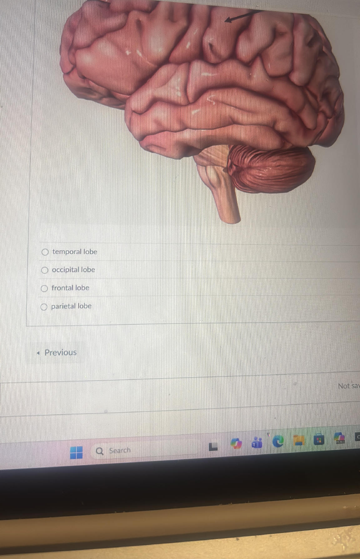 Identify the structure indicated by the | StudyX