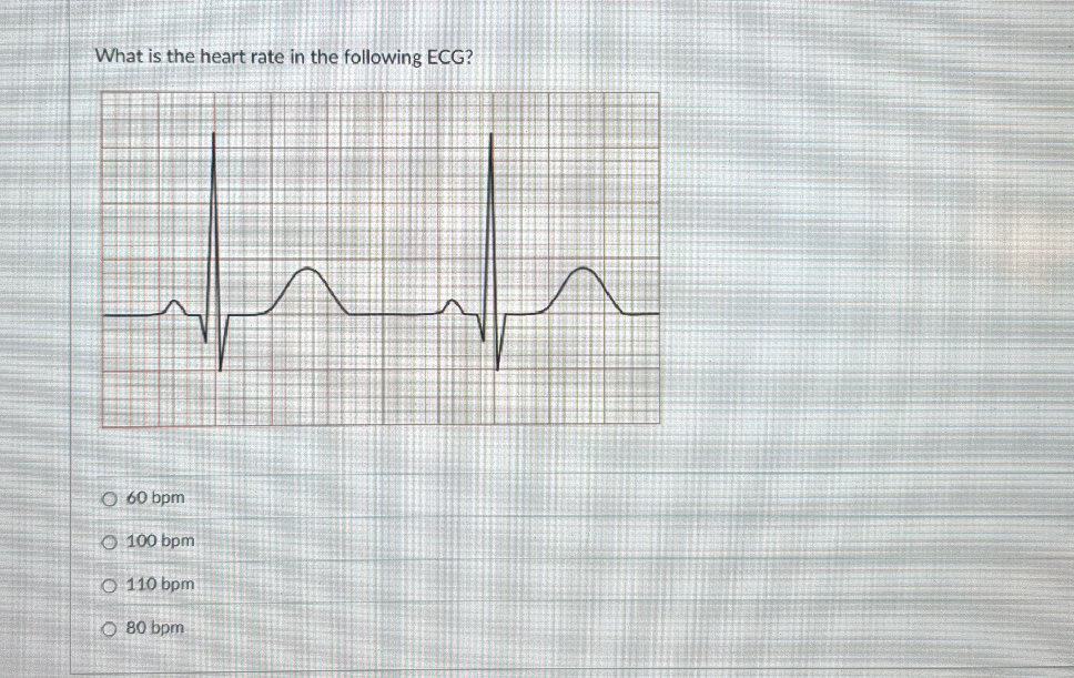 What is the heart rate in the following ECG? | StudyX