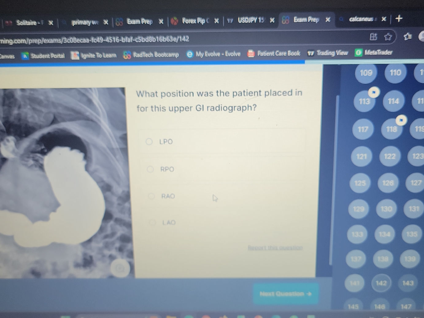 What position was the patient placed in for | StudyX