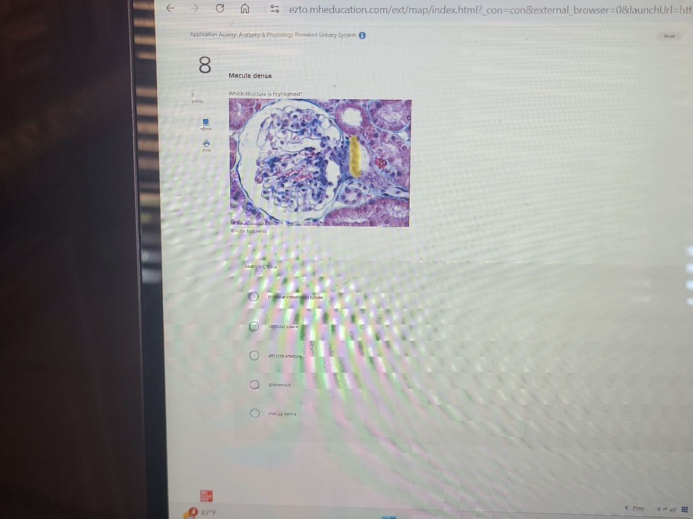 Macula densa Which structure is | StudyX